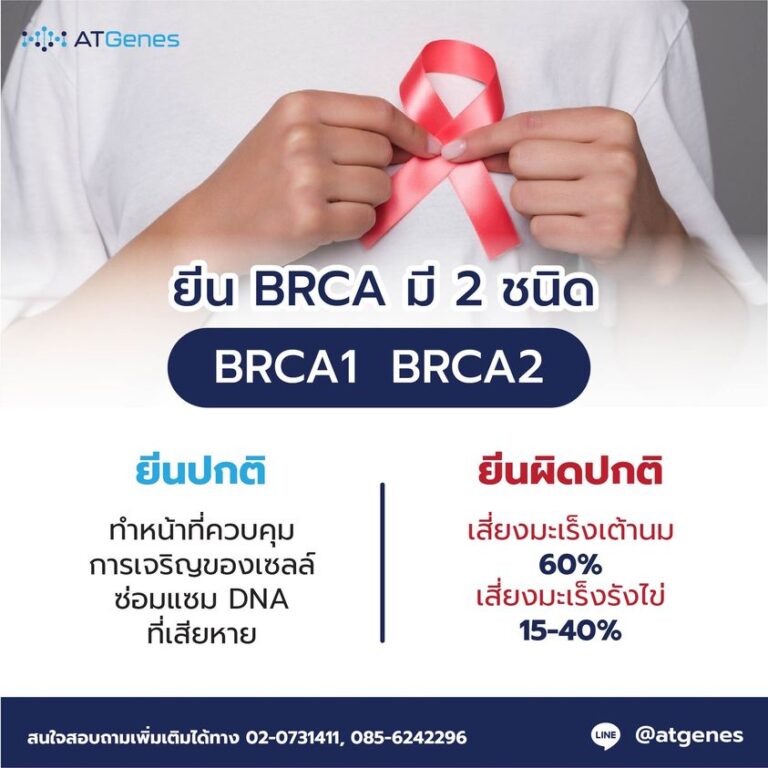มาทำความรู้จัก ยีน BRCA กัน - ATGenes
